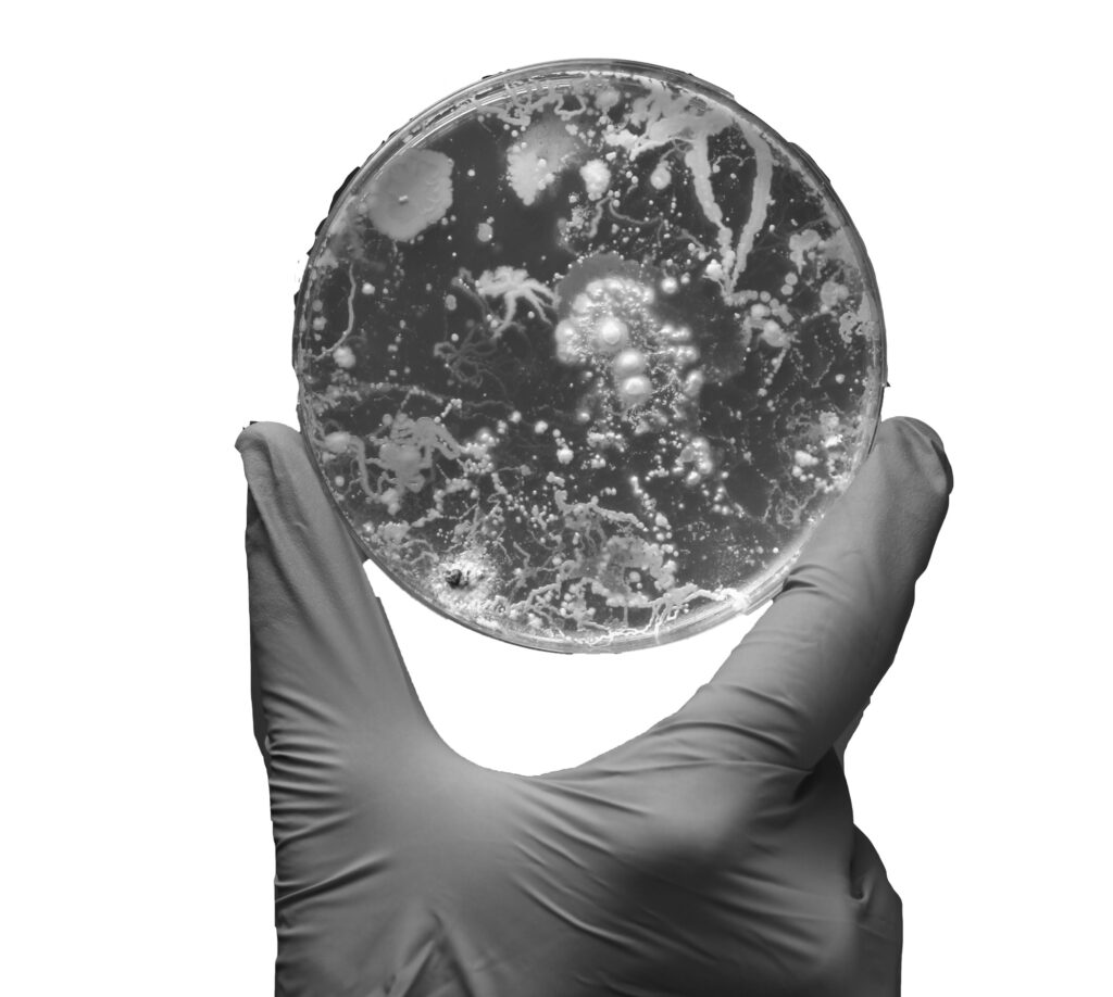 Luftambulansen forklart - Norsk Luftambulanse